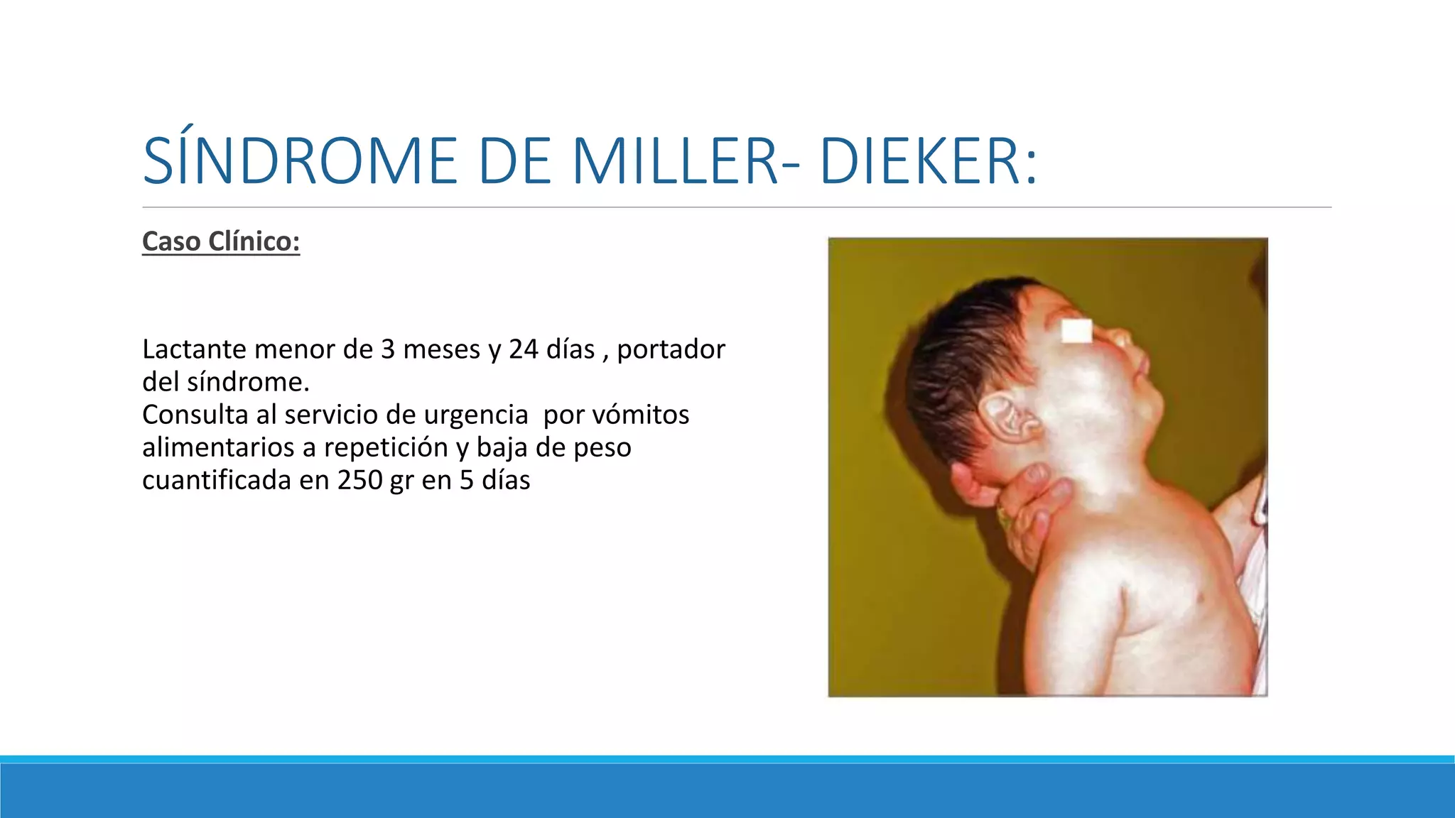 Sindrome de miller dieker | PPTX | Brain and Nervous System Disorders ...