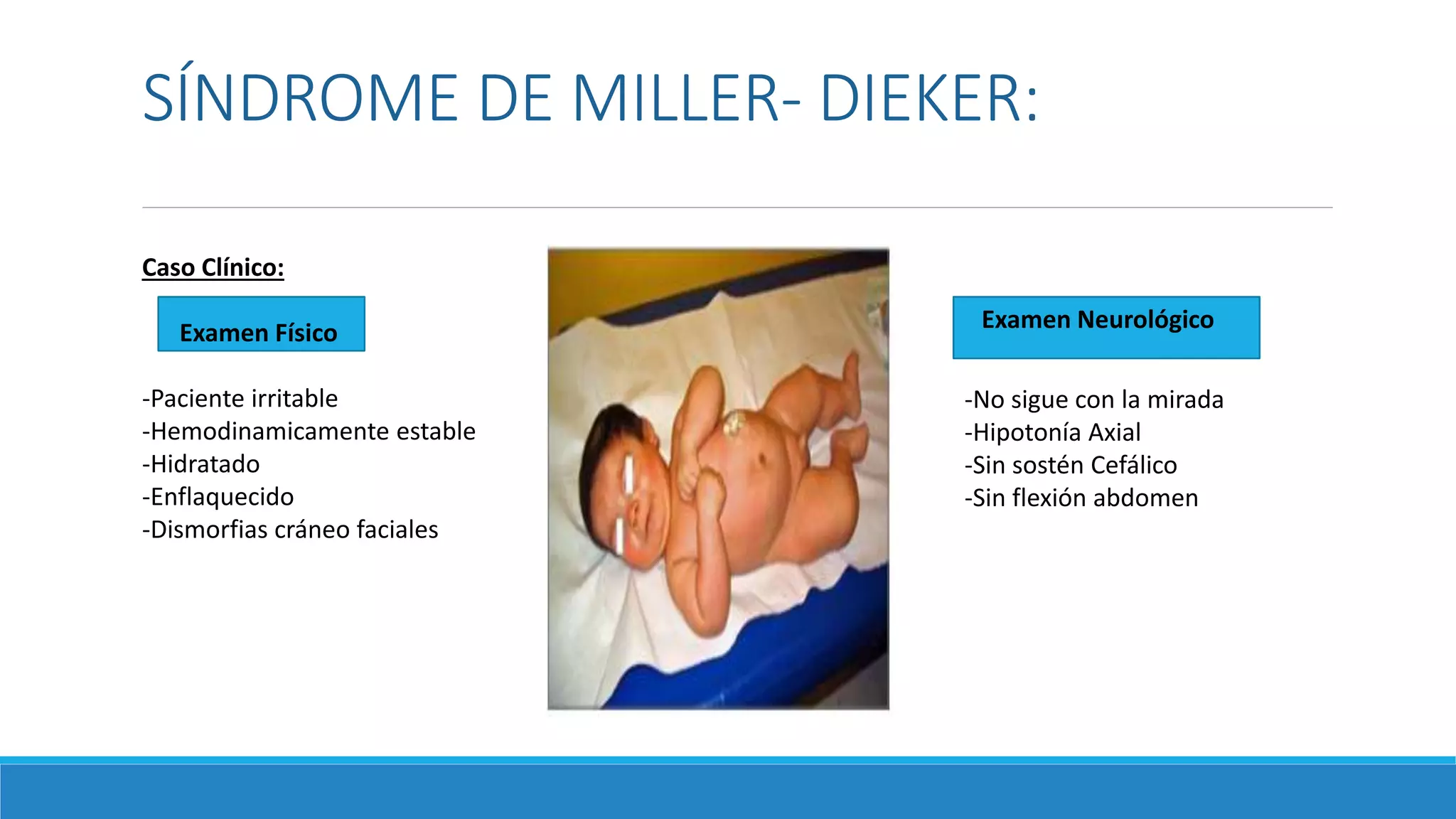 Sindrome de miller dieker | PPTX | Brain and Nervous System Disorders ...