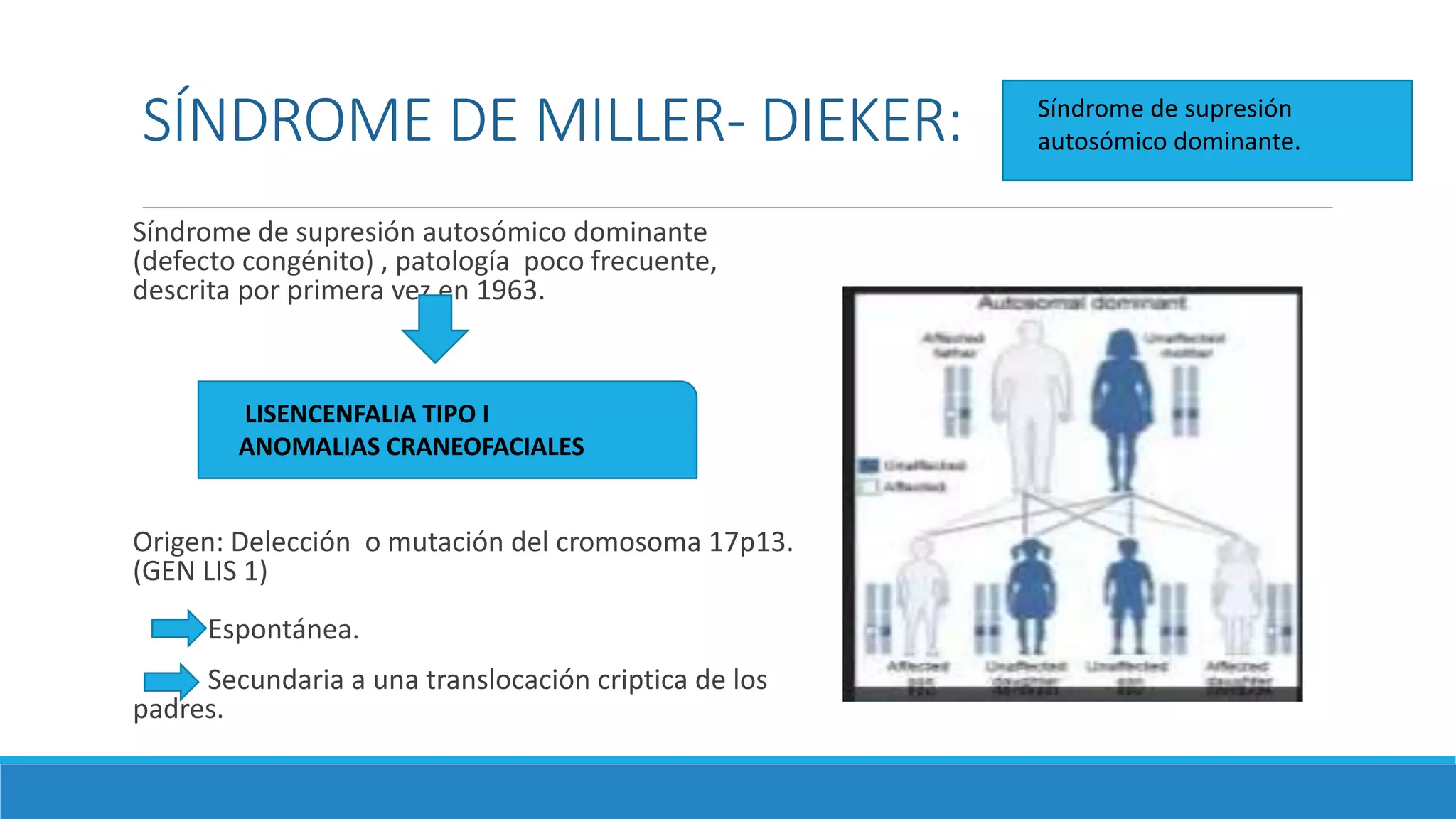 Sindrome de miller dieker | PPT
