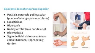 Sindrome de neurona motora | PPTX