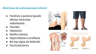 Sindrome de neurona motora | PPTX