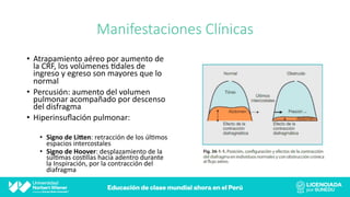 Sindrome de Obstrucción de las Vías Aéreas | PDF