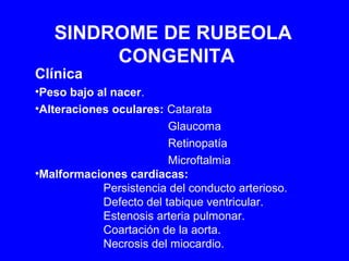 Sindrome de rubeola congenita | PPT