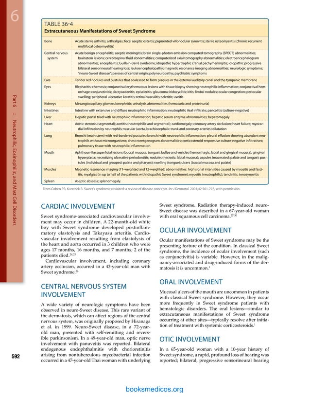 Dermatosis neutrofilicas variante síndrome sweet | PDF