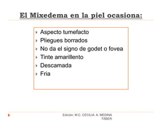 Sindrome edematoso | PPTX