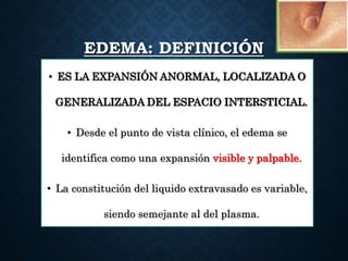Sx edematoso Sx edematoso síndrome edematoso emsindrome e | PPTX