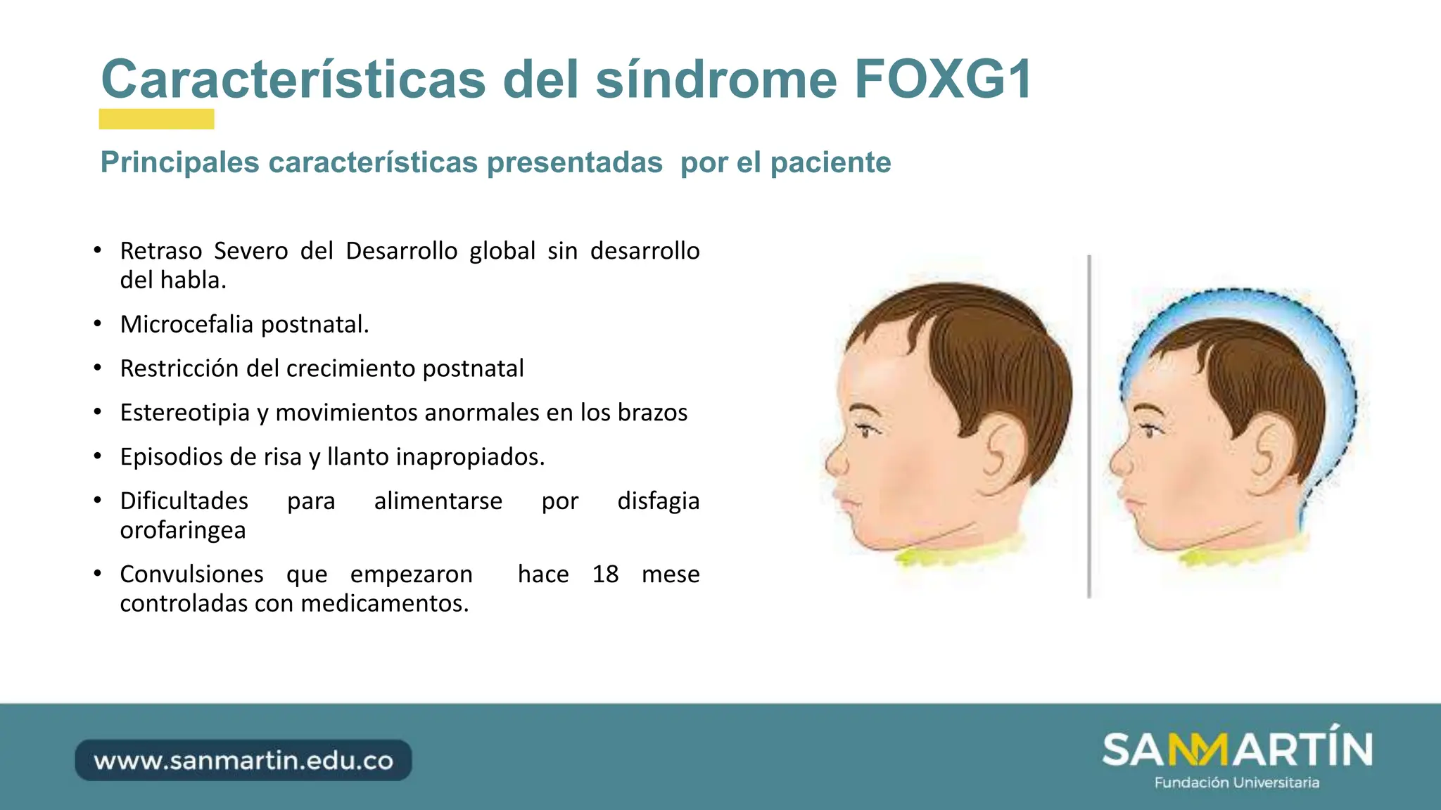 Sindrome FOXG1 - Genetica clinica - Presentación | PPTX | Brain and ...