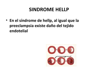 Sindrome hellp | PPT