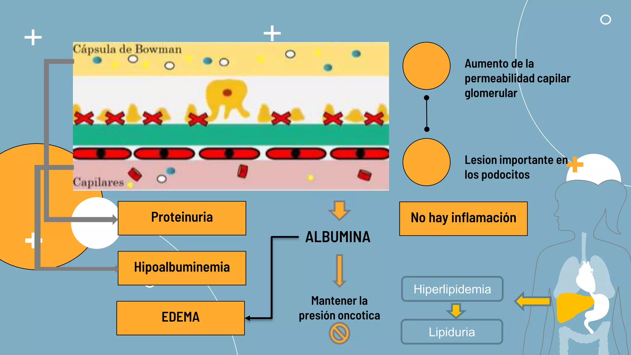 Sindrome nefritico y nefrotico.pptx