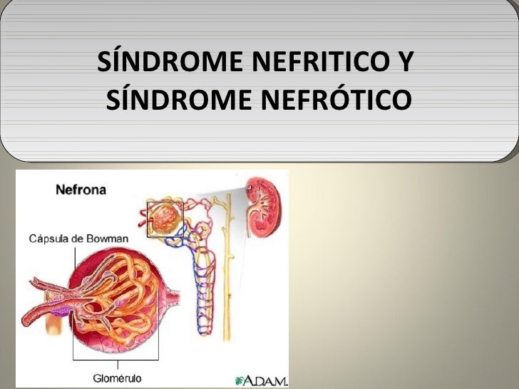 Sindrome nefritico y sindrome nefrótico