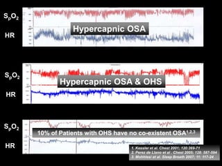 Sindrome obesidade hipoventilação tratamento cónico | PPTX