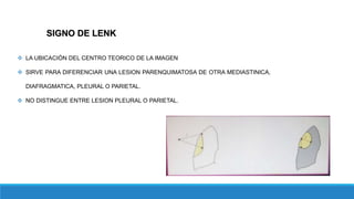 SINDROME PARIETAL.pptx