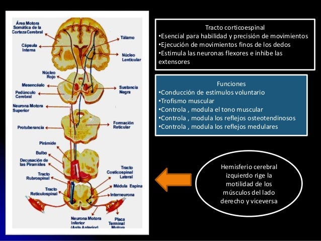 Qu Es El Sndrome Piramidal O Falsa Citica Clnica