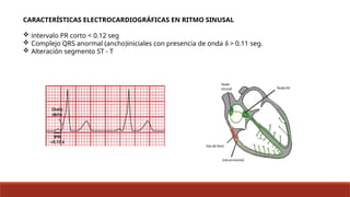 Sindrome preexcitacion.pptx psicologia y psiquiatras | PPTX