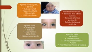 Sindrome Rubeola congénita | PPTX