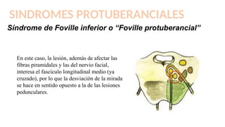 Sindromes alternos del tronco del encefalo.pptx