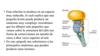 Sindromes alternos del tronco del encefalo.pptx