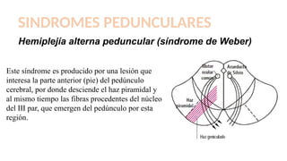 Sindromes alternos del tronco del encefalo.pptx