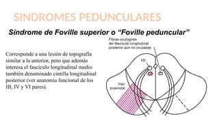 Sindromes alternos del tronco del encefalo.pptx