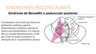 Sindromes alternos del tronco del encefalo.pptx