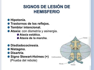 Sindromes Cerebelosos | PPTX