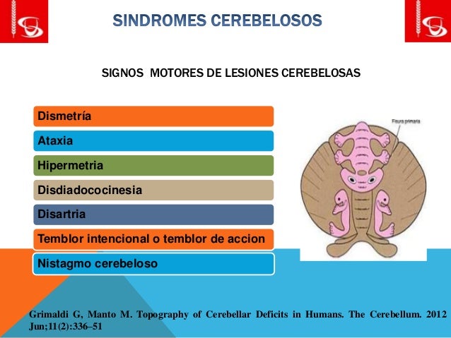 Síndrome Cerebeloso: Causas Y Principales Síntomas – QXMKH