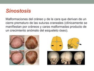 Malformaciones Congénitas de la región Maxilofacial | PPT