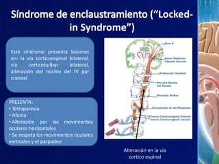 Síndromes del tronco cerebral | PPTX