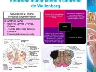 Síndromes del tronco cerebral | PPTX