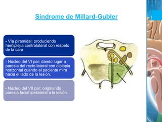 Síndromes del tronco cerebral | PPTX