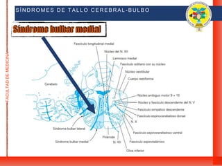 Síndromes de mesencéfalo y bulbo | PPTX