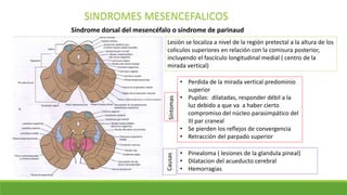Sindromes de tallo cerebral | PPTX