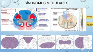 Sindromes neurologicos | PPTX