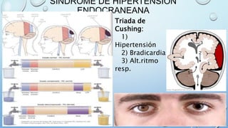 Sindromes neurologicos | PPTX