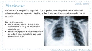 Sindromes_pleuropulmonares_exposicion.pptx