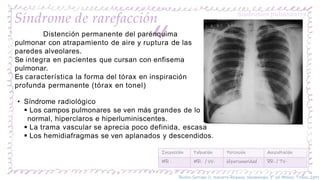 Sindromes_pleuropulmonares_exposicion.pptx