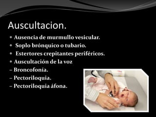 Sindromes pulmonares | PPTX