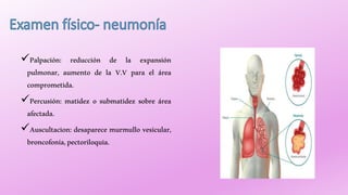 Sindromes pulmonares | PPTX