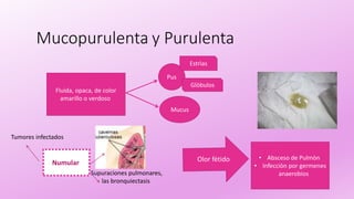 Sindromes pulmonares | PPTX