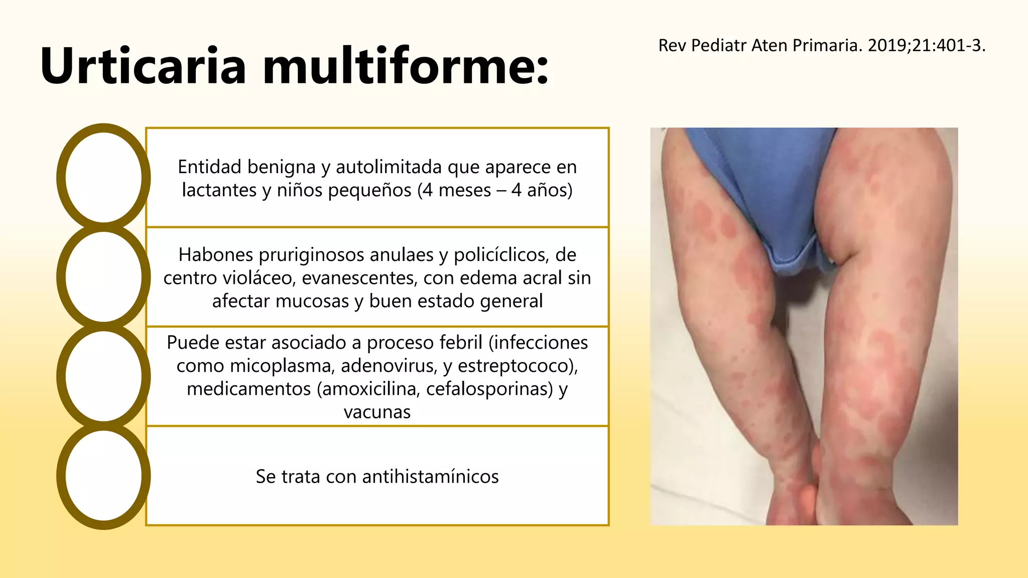 Síndromes Urticarianos Urticaria Aguda Urticaria Crónica Y Urticaria