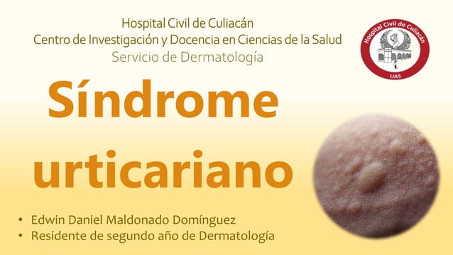Urticaria Crónica Clasificación Diagnóstico Y Tratamiento Ppt