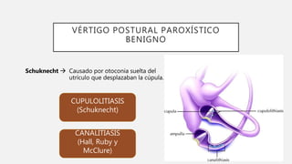 Sindromes vestibulares perifericos y meniere | PPTX