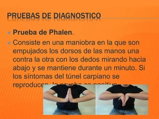 Sindrome_tunel_carpiano.pptx