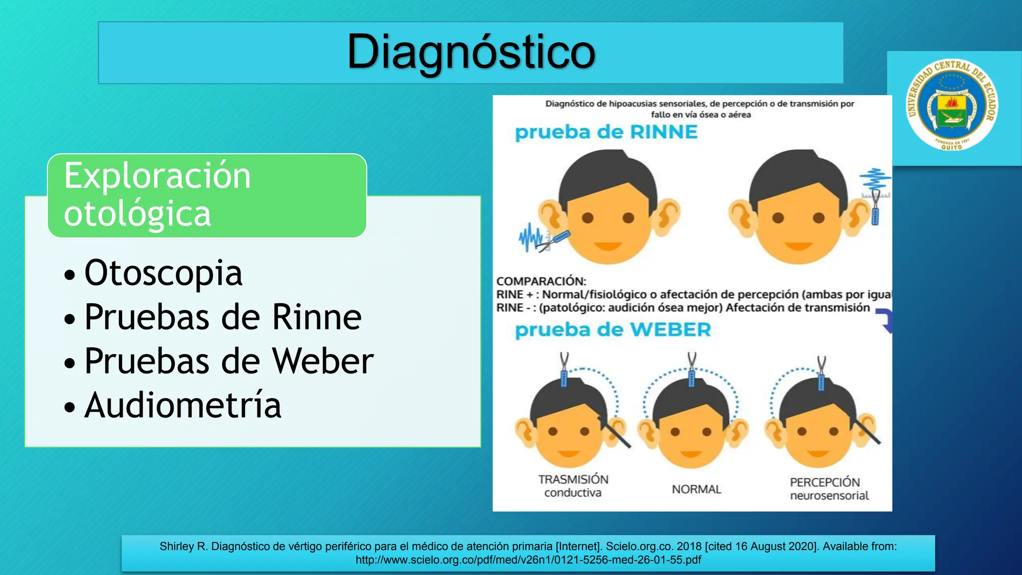 Síndrome Vertiginoso Periférico.- Neurología pptx | PPTX