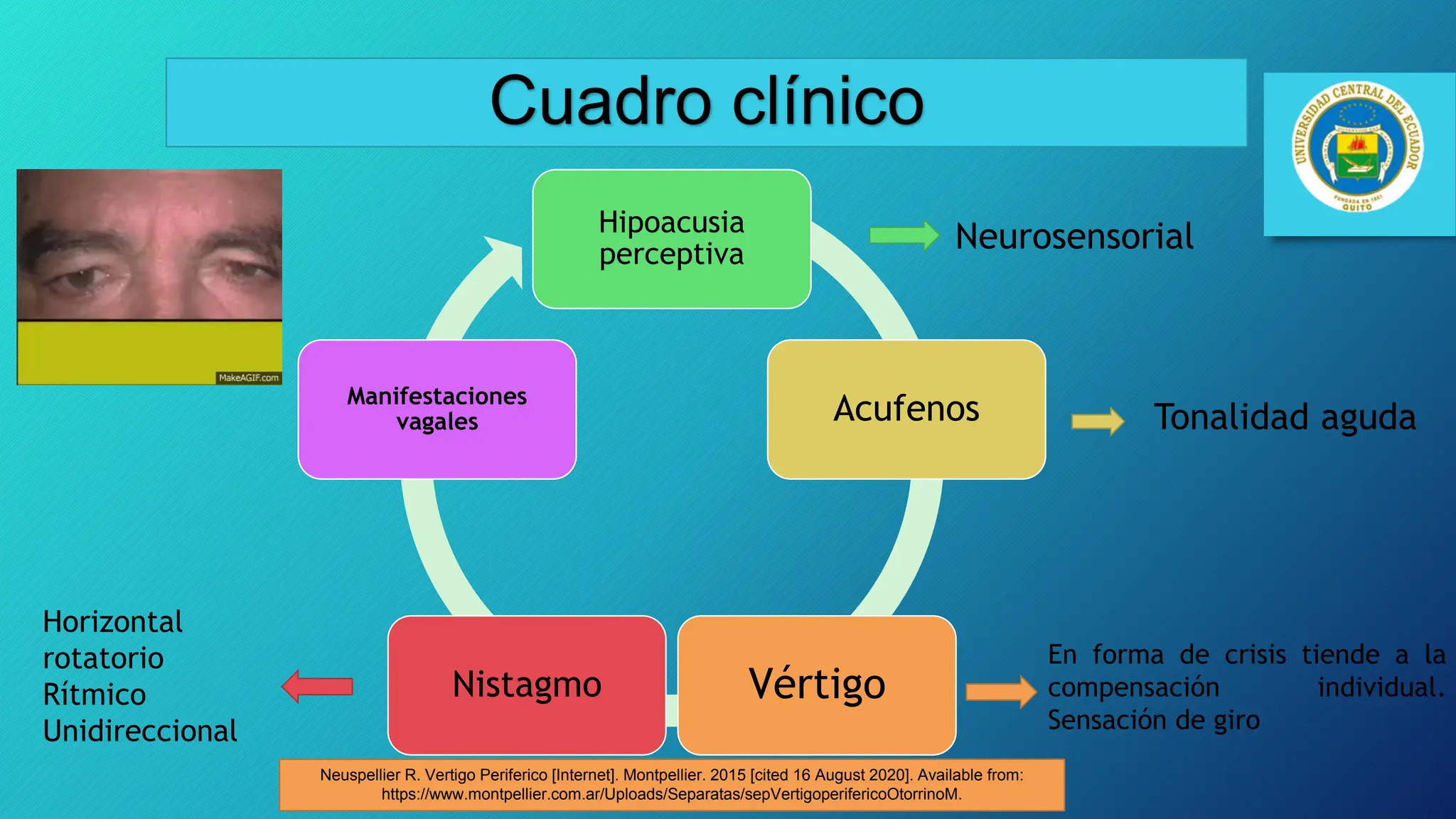 Síndrome Vertiginoso Periférico.- Neurología pptx | PPTX