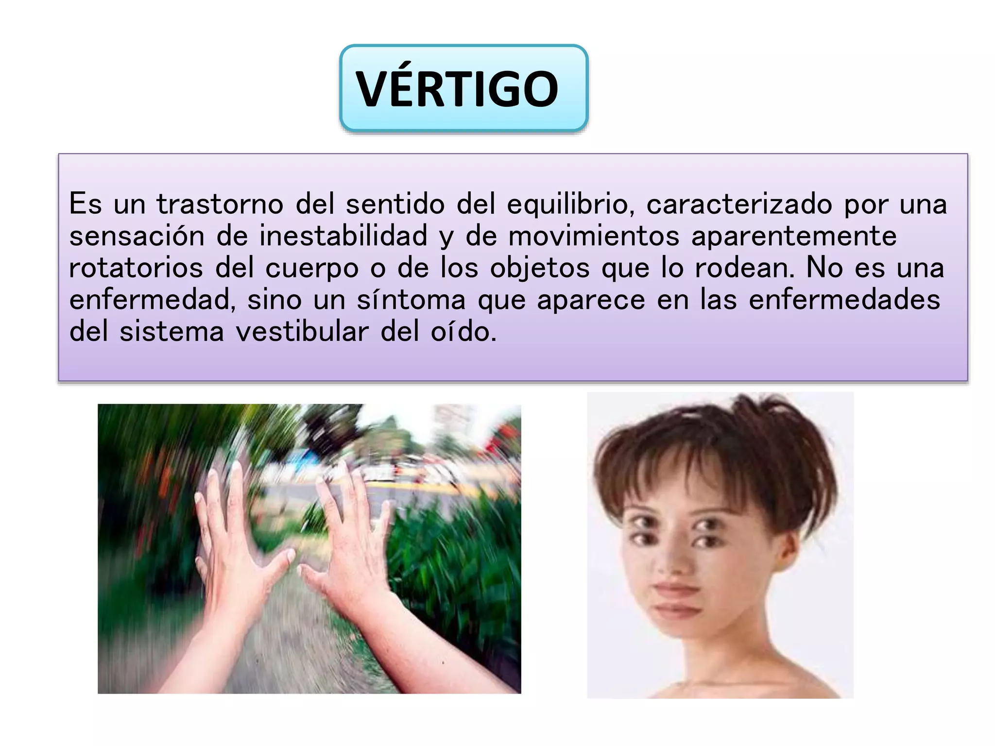 SINDROME VERTIGINOSO VERSION FINAL.pptx