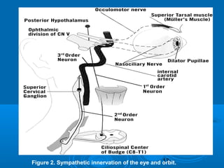 Sindrom horner | PPT