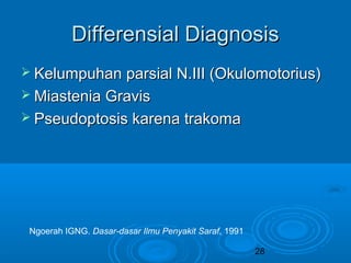 Sindrom horner | PPT