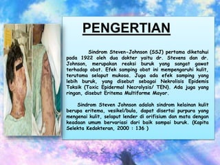 Sindrom steven johnson (ssj) | PPTX