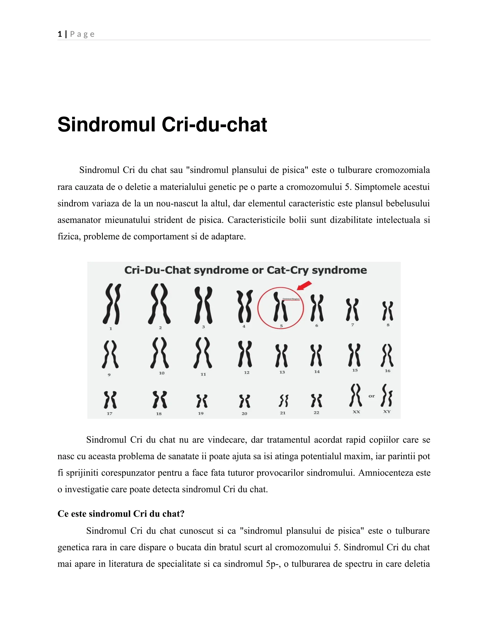sindromul cri-du -chat. docx referat si imagini | DOCX